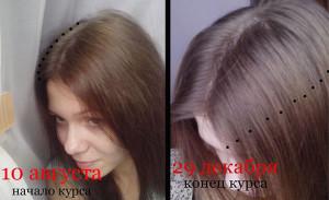 Препараты Дермахил (Dermaheal): классификация, терапевтический эффект ...