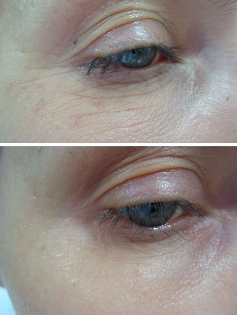 Препараты Дермахил (Dermaheal): классификация, терапевтический эффект ...